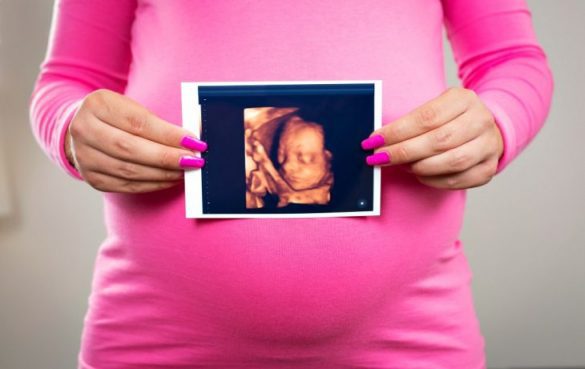 Wrong Gender Ultrasound: Everything You Should Know - 2025